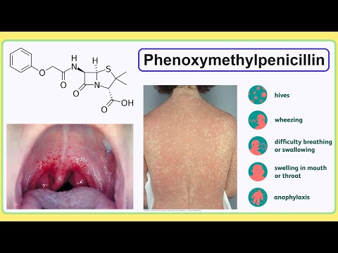 phenoxymethylpenicillin