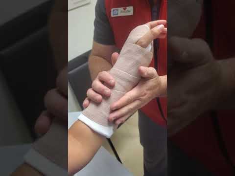 Fiberglass Wrist Splint, Volar Splint, How to Make...