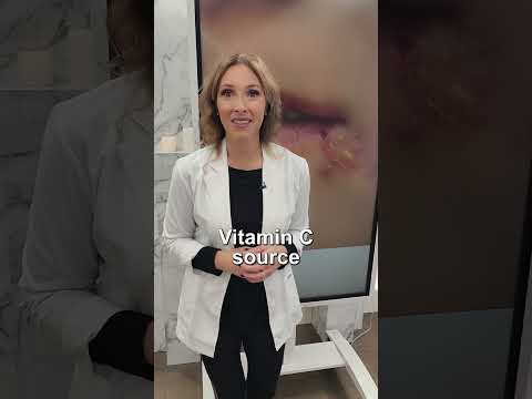 3 Tips for Cold Sores #shorts