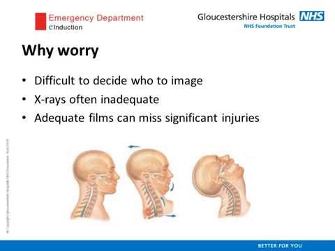 Part 1 – Approach to suspected C-spine injuries – EMCAGE