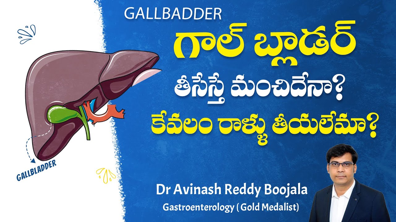 Cholecystectomy (Gallbladder Removal) | Gastroenterology | Mallika Hospitals