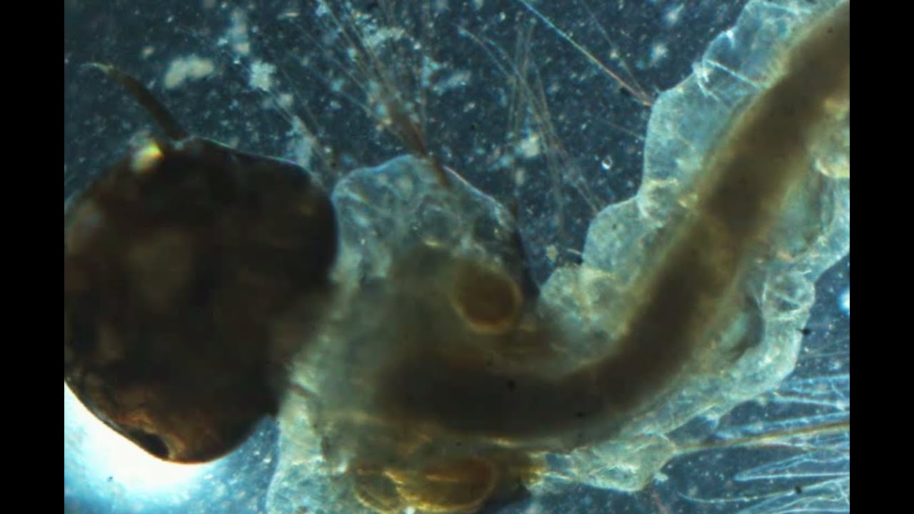 Mosquito Larvae Under Microscope  (Darkfield mode)