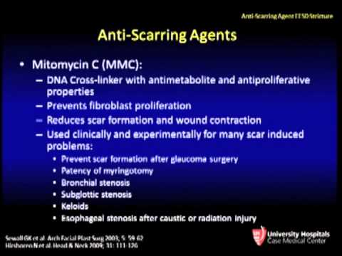 Preliminary Data On Anti-Scarring Agents In The Prevention Of Post Esophageal Endoscopic Submucosal