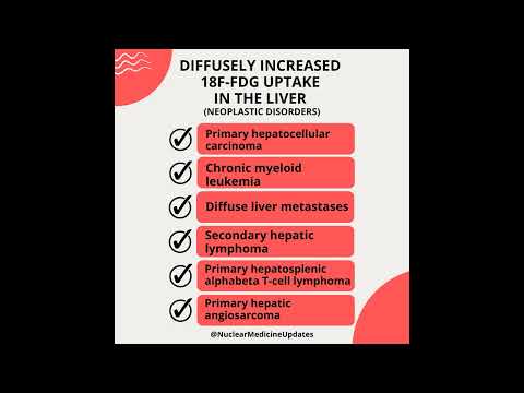 Diffusely increased 18F-FDG uptake in the liver (neoplastic and non-neoplastic disorders)