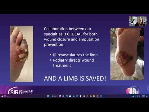 Wound Care Basics for the Vascular Specialist