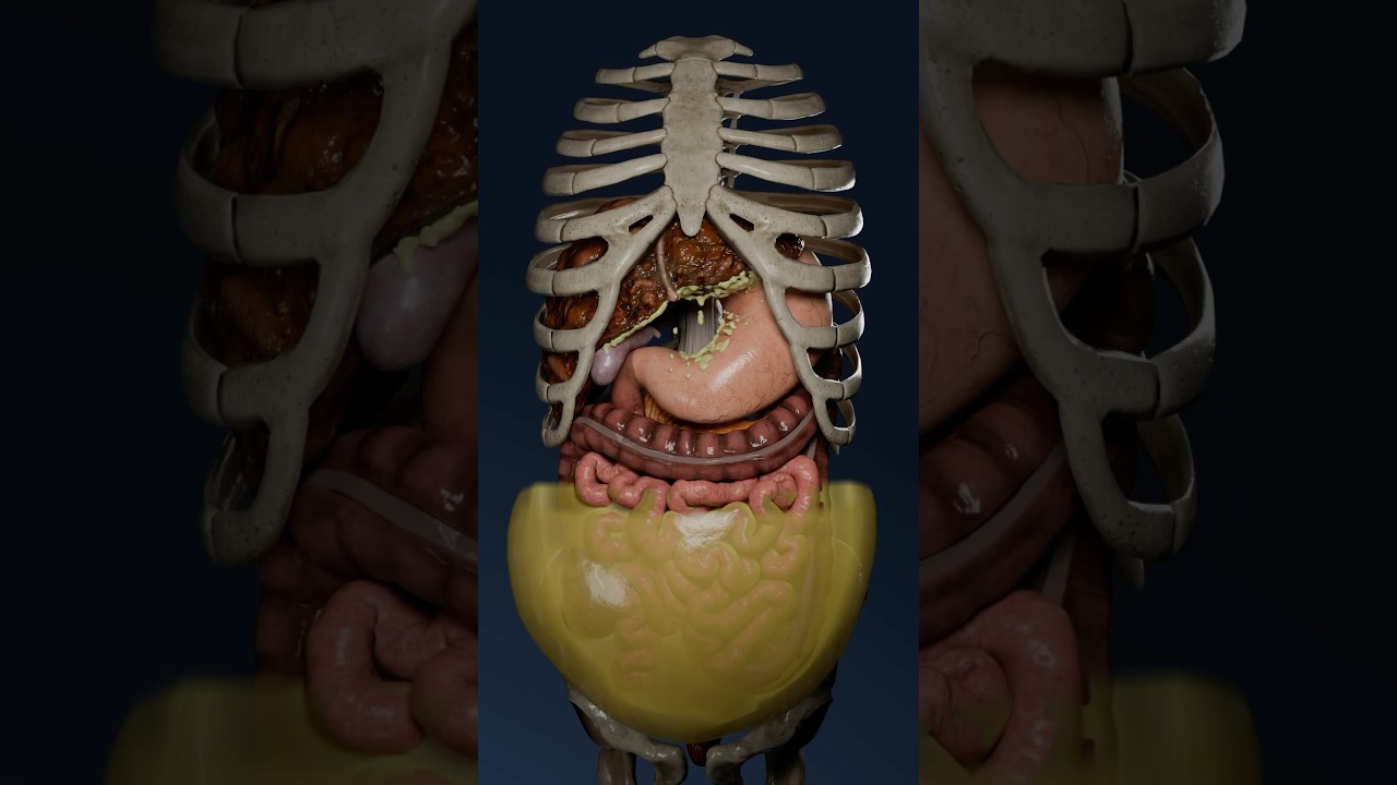 Ascites in liver cirrhosis: exploring the accumulation of fluid in 3D