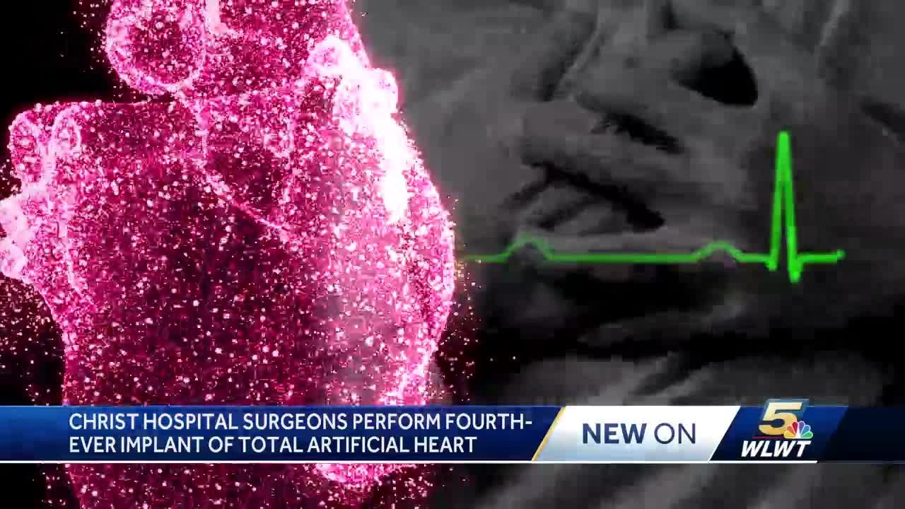 Christ Hospital surgeons perform fourth-ever implant of total artificial heart