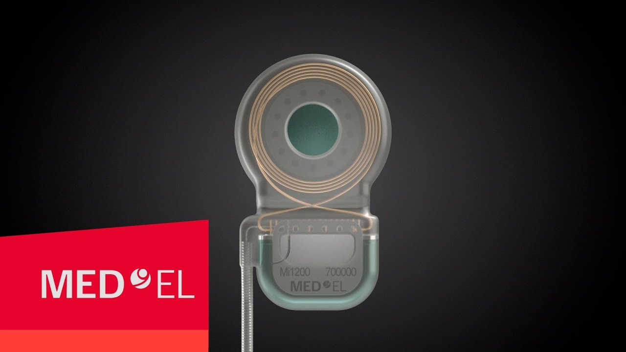 MRT mit einem Cochlea-Implantat