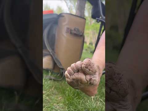 Feet after 100 miles run @BrockCovington