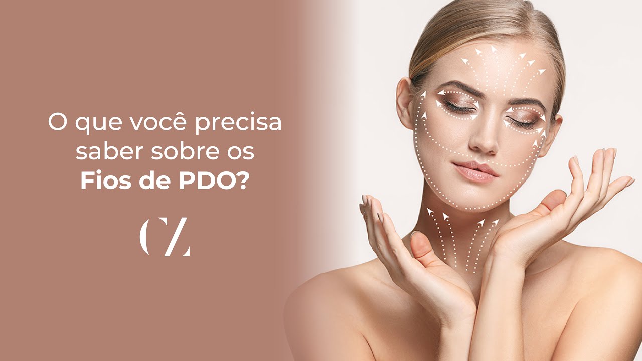 O que você precisa saber sobre os Fios de PDO