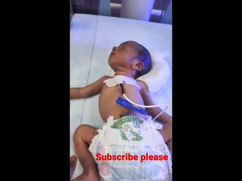 New born baby treatment. #NICU baby care.