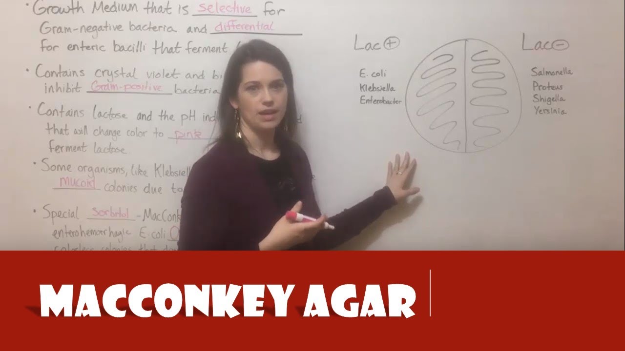 MacConkey Agar