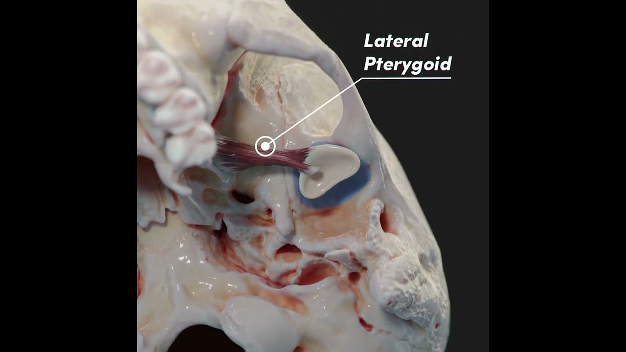 Temporomandibular joint (TMJ) and its articular disc