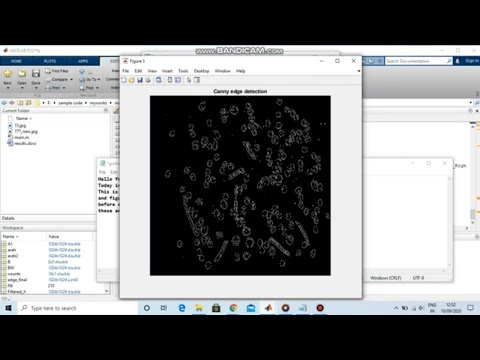 Canny edge detection in Matlab code to detect edges | Edge detection matlab