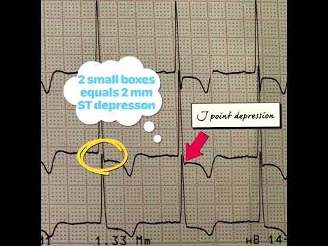 How to measure the j point correctly?