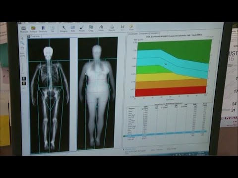 Fat scanner reveals hidden risks