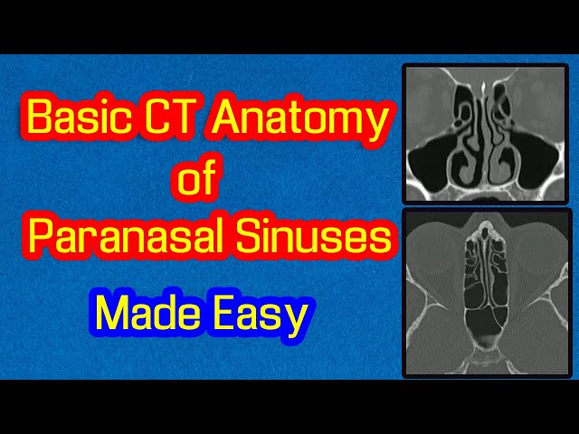 Understanding The Anatomy Of Paranasal Sinuses A Comprehensive Guide Galaxy Ai Galaxy Ai