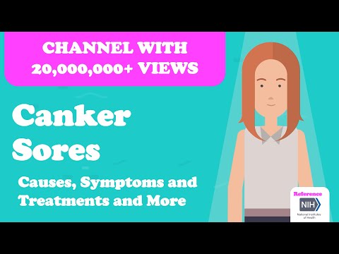 Canker Sores - Causes, Symptoms and Treatments and More