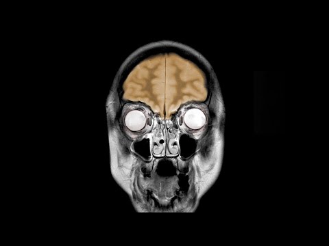 A Dad Drank 50 Beers Everyday For 6 Weeks. This Is What Happened To His Brain. ft @JustinWhangYt