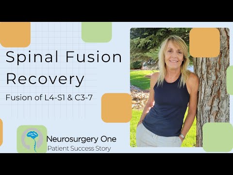 Back in action: Spine fusion recovery