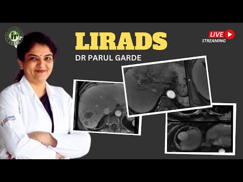 IR Masterclass: LIRADS: Dr Parul Garde Hepatobiliary Imaging