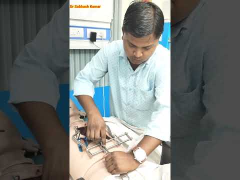 Balfour Retractor A Surgical Abdominal Instrument #science #Dr_subhash_kumar