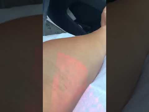 Doctor’s Curbside blood draw COVID antibody test labcorp quest Star Trek Laser vein finder
