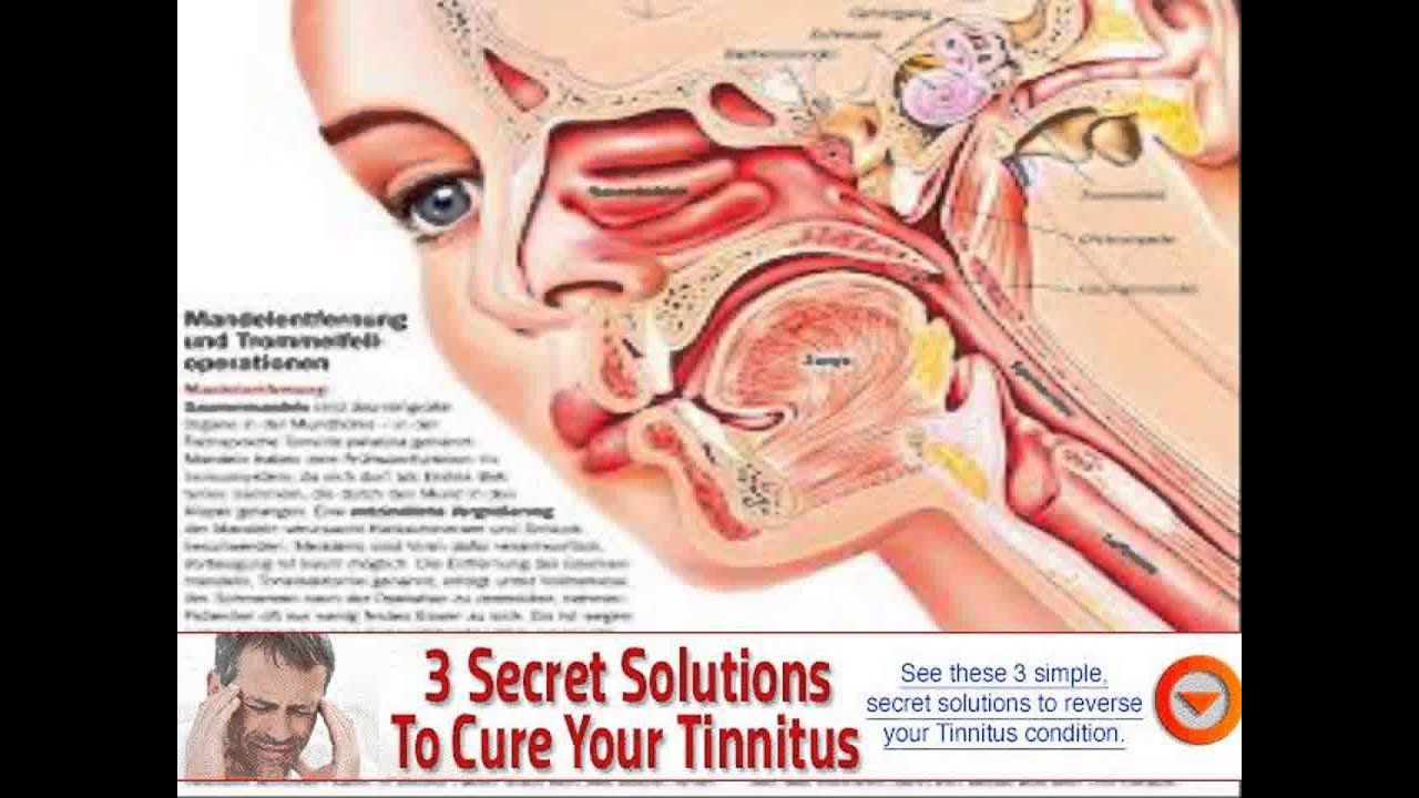 conductive deafness ppt