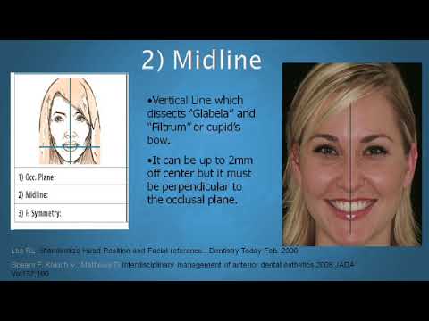 Smile Design Using the Dento-Facial Diagnosis System