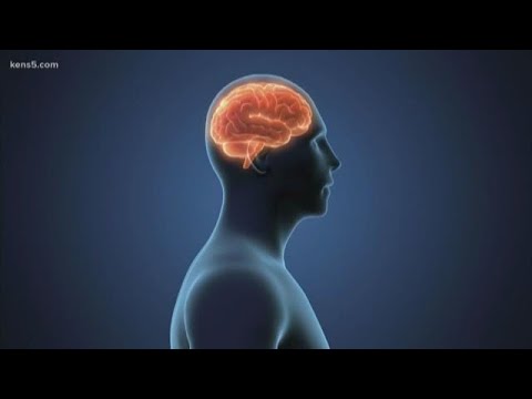 Getting a stroke from popping your neck?