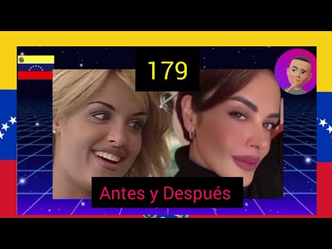 179 ACTORES Y ACTRICES VENEZOLANAS/ ANTES Y AHORA!! #venezuela