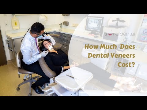 How Much Does Dental Veneers Cost?