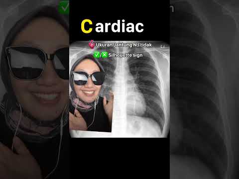 Tips baca foto Toraks !