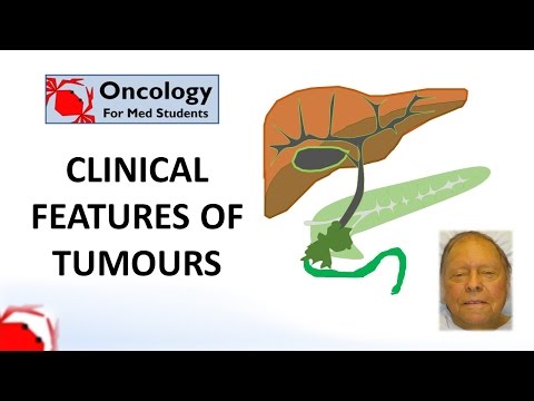 Clinical features of cancer: how cancers cause clinical symptoms