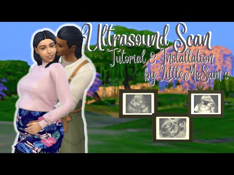 HOW TO INSTALL - Ultrasound Scan | Tutorial | Sims 4| Frauenarzt & Ultraschall 🤰🩺