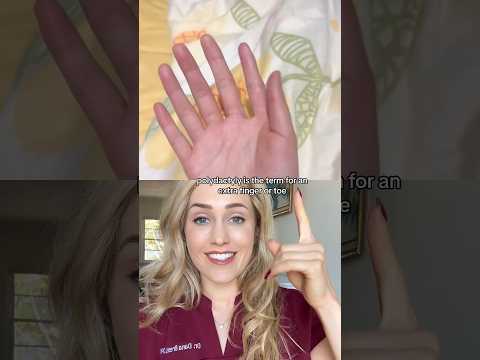 Doctor reacts: born with 6 fingers?