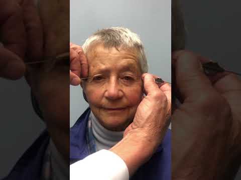 Ptosis Explained