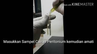 tesfuzziblog: Tes Rivalta Adalah