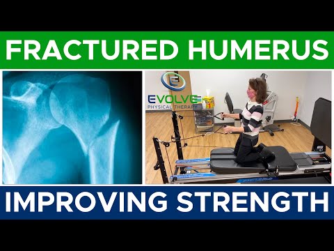 Fractured Humerus | Improving Strength | Part 2