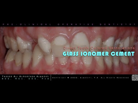 Glass Ionomer Cement