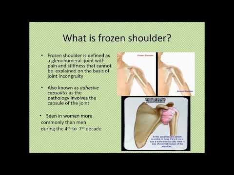 New treatment for frozen shoulder