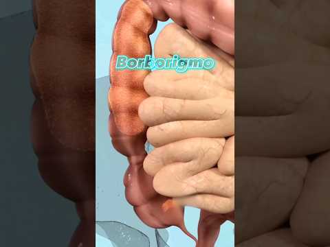 BORBORIGMO | DEFINICI脫N M脡DICA VOCABULARIO TERMINOLOG脥A - Interpreter training