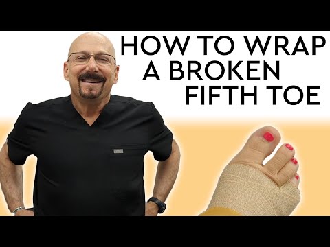 How to Wrap a Broken Fifth Toe