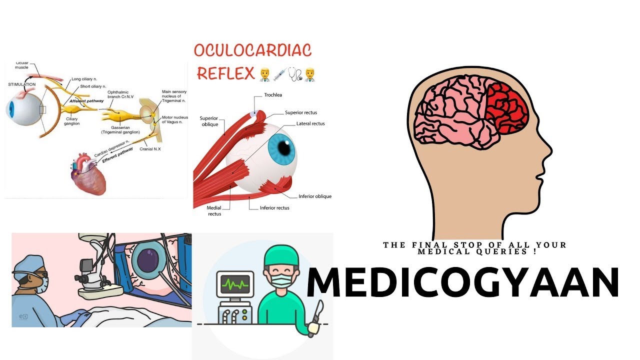 The Ocular Cardiac Reflex - What Is It?
