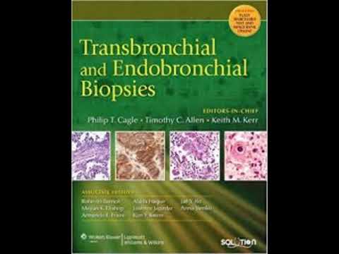 Transbronchial and Endobronchial Biopsies