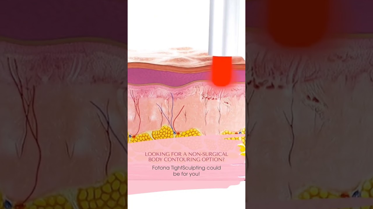 Hydrafacial & Microdermabrasion in Brisbane | Deep Cleansing & Hydration | Primavera Clinic