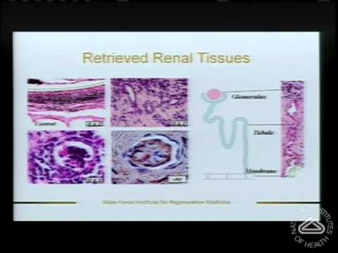 Regenerative Medicine: Prof. Anthony Atala discusses its past, present ...