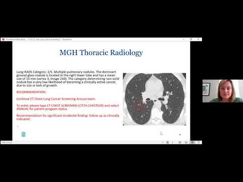 Newton-Wellesley Medical Group Lunch & Learn: Pulmonary nodule clinic