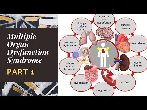 Multiple Organ Dysfunction Syndrome (MODS) | Part 1