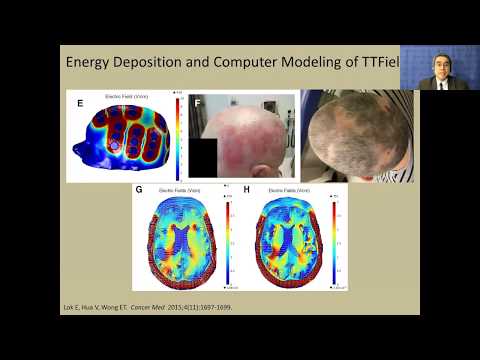 Brain Tumor Awareness Month Webinar Series: Dr Eric Wong